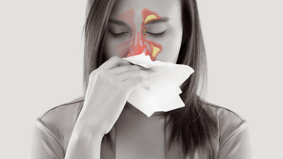 Deciphering Sinus Headaches Migraine Vs Sinusitis Migraine Canada